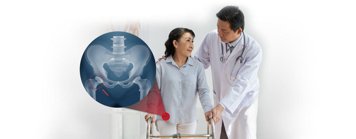 Fracture Liaison Services Programme | Elderly Fall Prevention